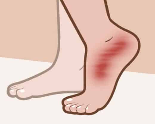 Understanding Rug Burns: 6 Powerful Points to Consider! - Rouzati Rugs